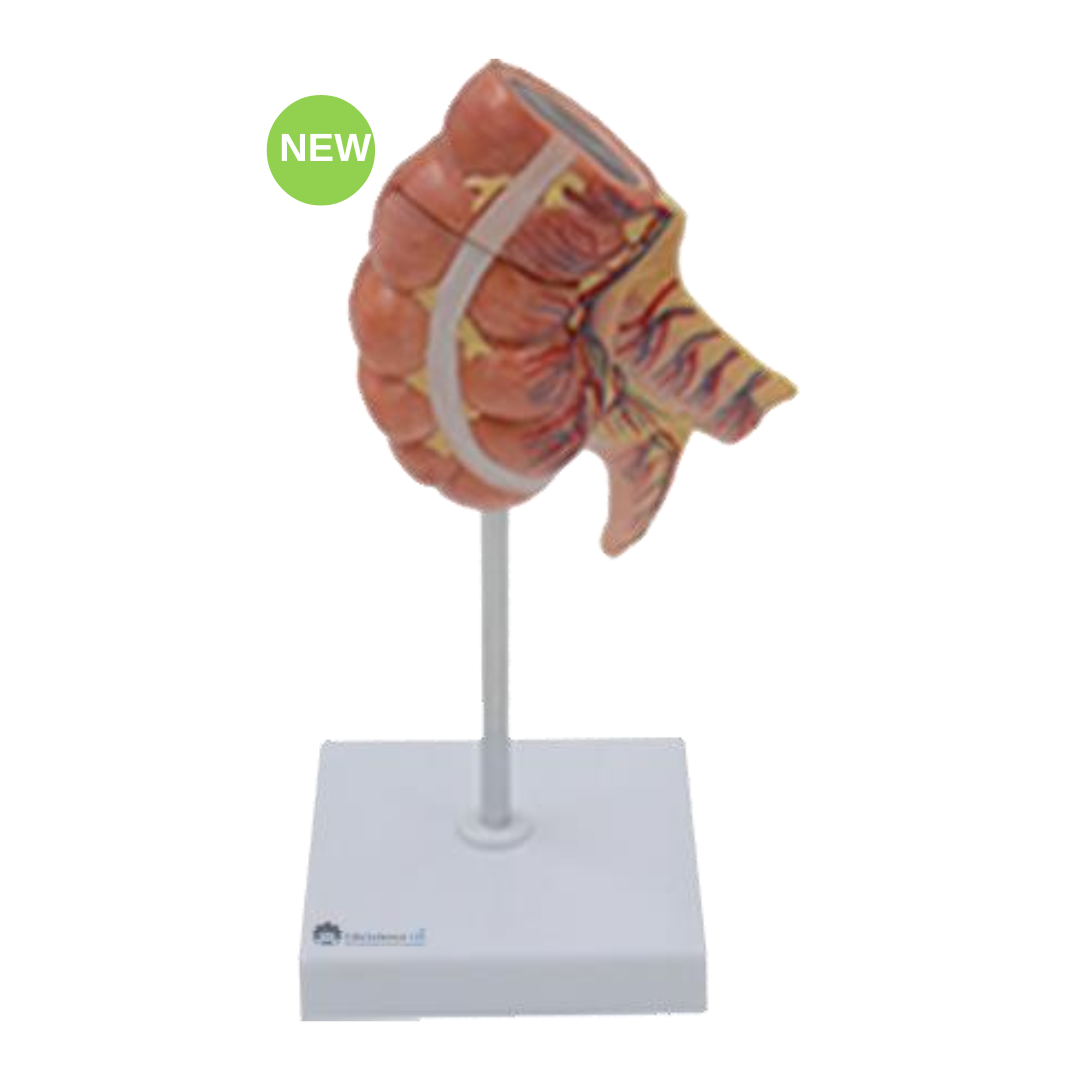 Appendix And Caecum Model – My Store